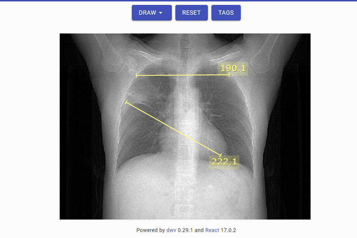 DWV及其React实践简要学习 - Dream Fields